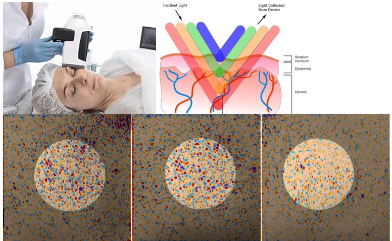 ProLon improves healthy skin – Prolon Australia